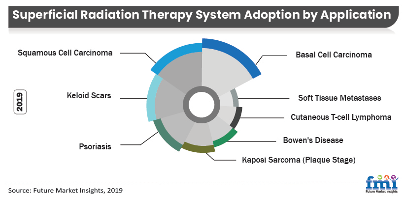 Superficial Radiation Therapy System Market: The Rise of ‘Non-Invasive ...